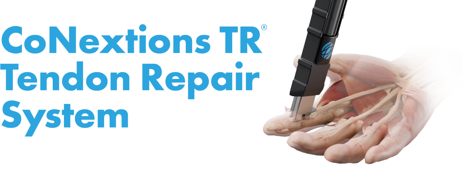 CoNextions TR Tendon Repair System
