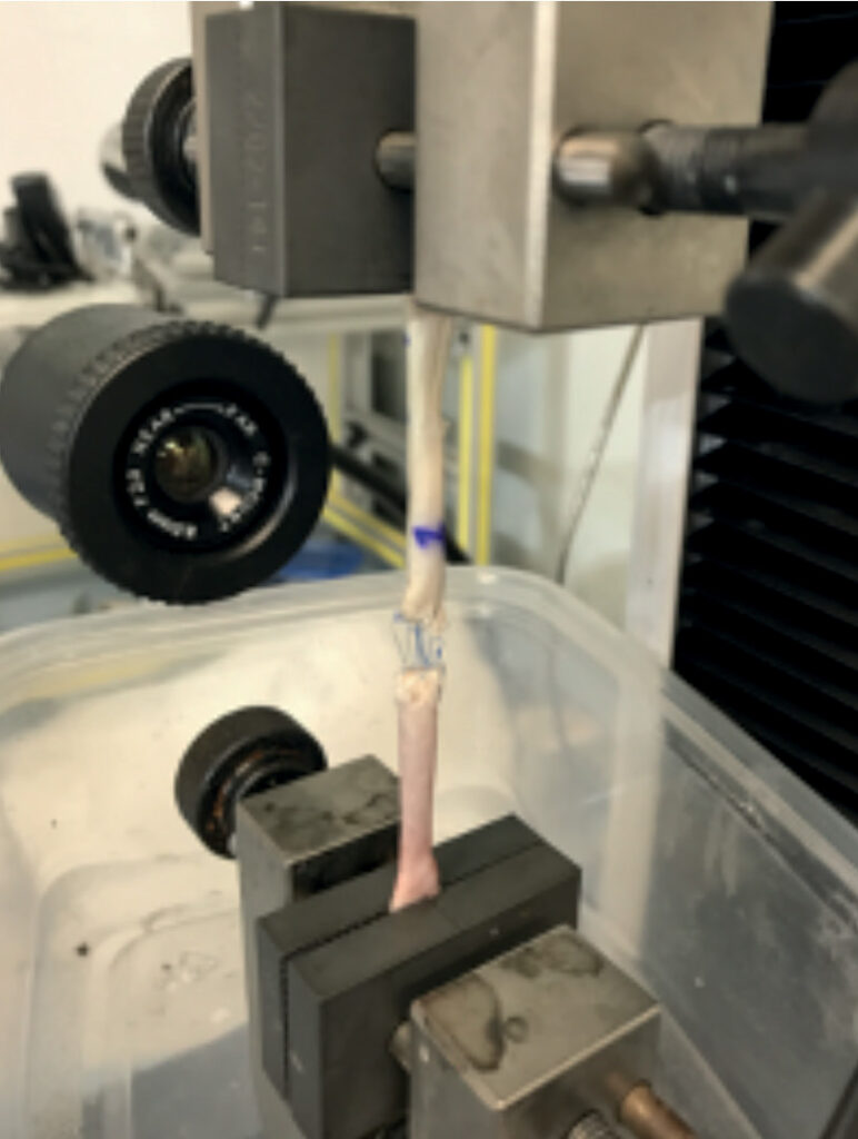 Biomechanical Comparison Of Repair Strength