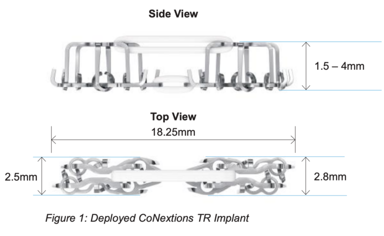 CoNextions TR Clinical Trial Summary