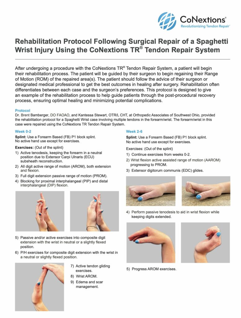 Spaghetti Wrist Rehabilitation Protocol Example