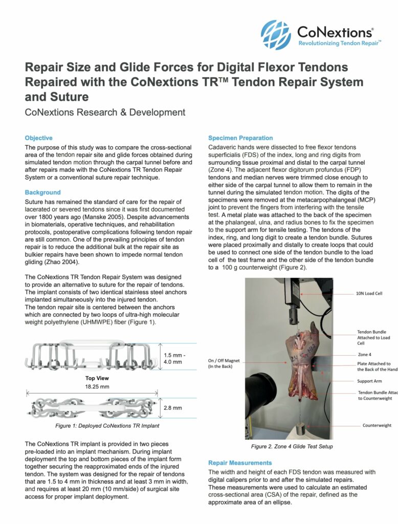 CoNextions TR Tendon Repair System Zone 4 Glide White Paper